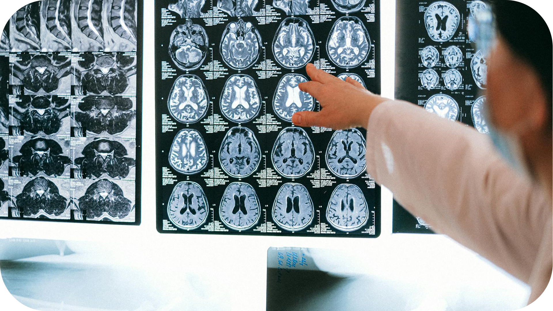 Using ChatGPT may reduce your brain activity, a new study claims - Vidadu